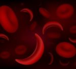 La drépanocytose : ses causes et ses conséquences – Laboratoire Barla