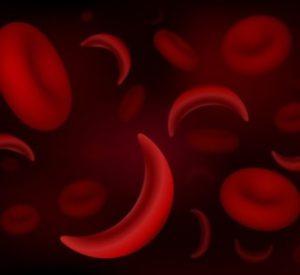 La drépanocytose : ses causes et ses conséquences – Laboratoire Barla