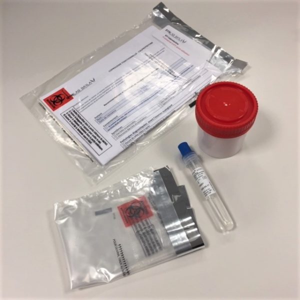 Kits Calprotectine, coprologie fonctionnelle, lot de 10 – Laboratoire ...